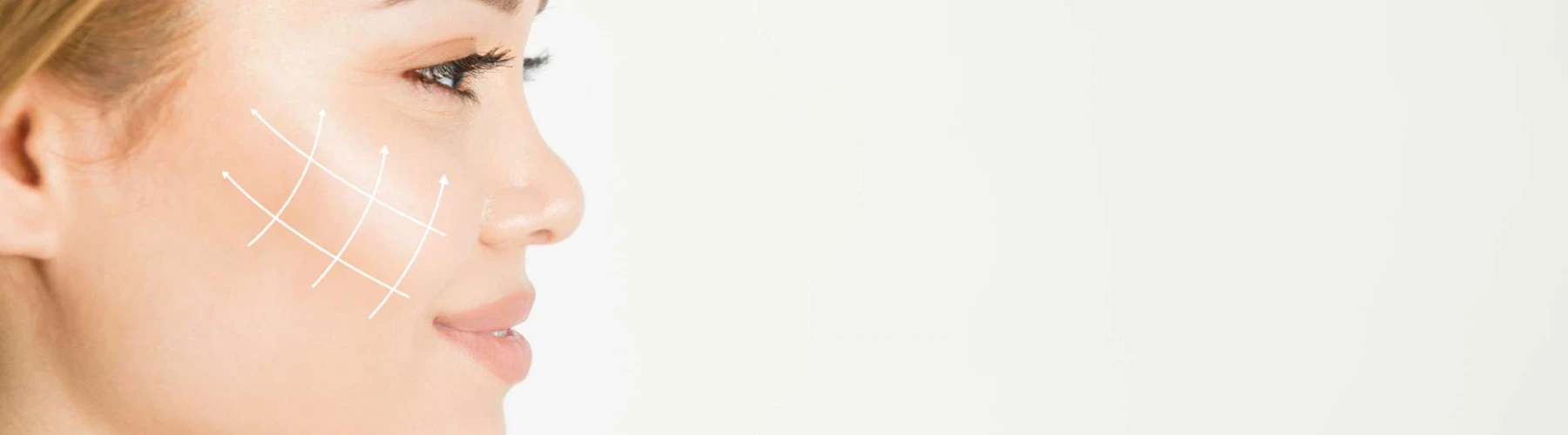 Injection Acide Hyaluronique Pommettes Visage - Médecine Esthétique ...